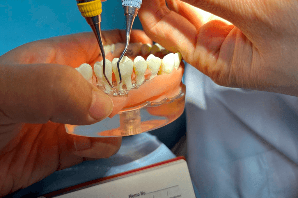 ¿Cuándo se hace una endodoncia? 5 síntomas clave